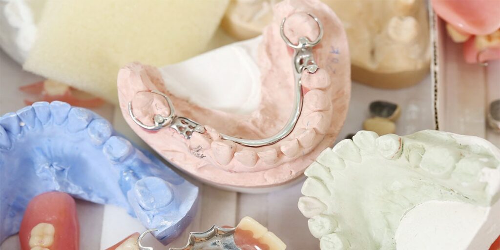 De plaat- of frameprothese - Tandartspraktijk Eindhoven